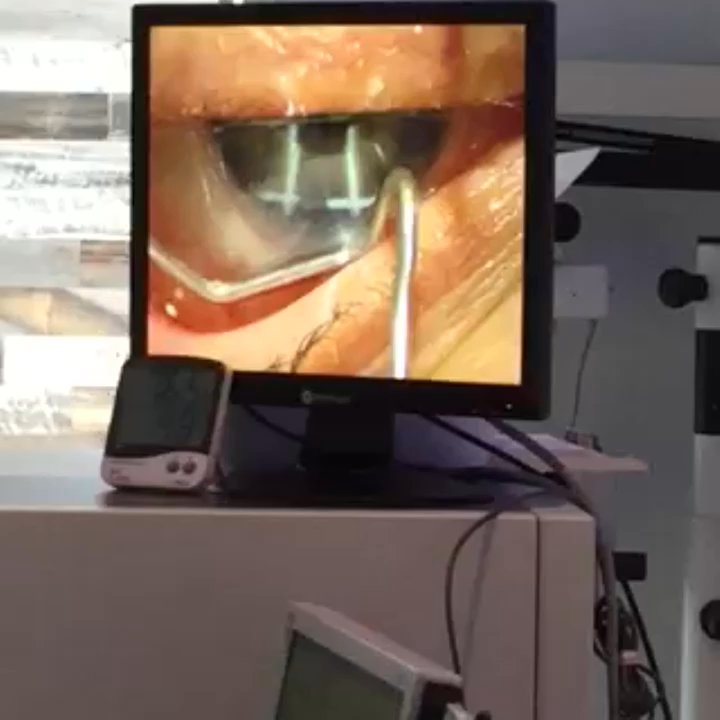 SHARPEVISION MODERN LASIK & LENS - Updated October 2025 - 48 Photos ...