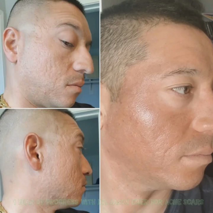 JASON EMER, MD - Updated April 2025 - 1127 Photos & 502 Reviews - 9201 ...