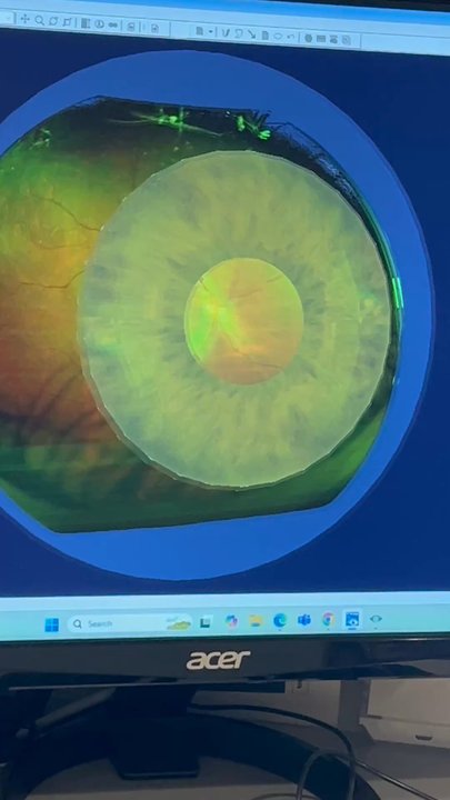 EYEDIOLOGY VISION CARE - Updated December 2025 - 77 Photos & 198 ...