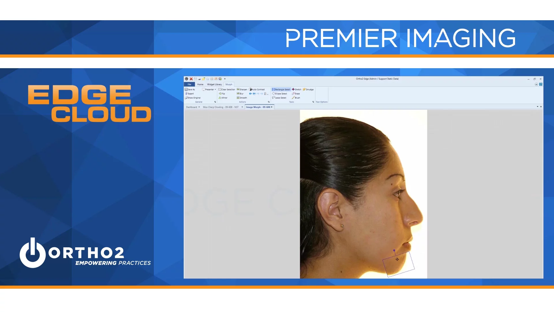 Ortho2 - Online Scheduling Setup